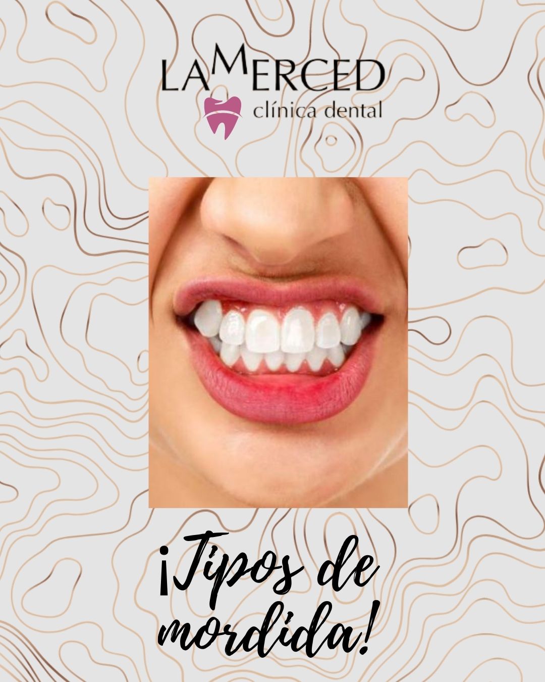 Tipos de mordida - Clínica la Merced